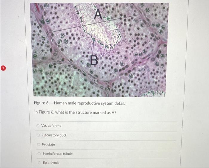 [Solved]: Figure 6 - Human male reproductive system detail.
