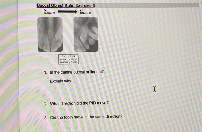 Solved Buccal Object Rule: Exercise 3 PA IMAGE 1 PA IMAGE 2 | Chegg.com