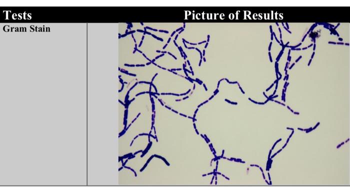 Enterococcus Faecium Gram Stain