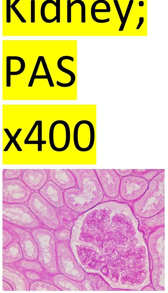Solved Image 6B: Liver; PAS Control Image 6B: Liver; PAS | Chegg.com