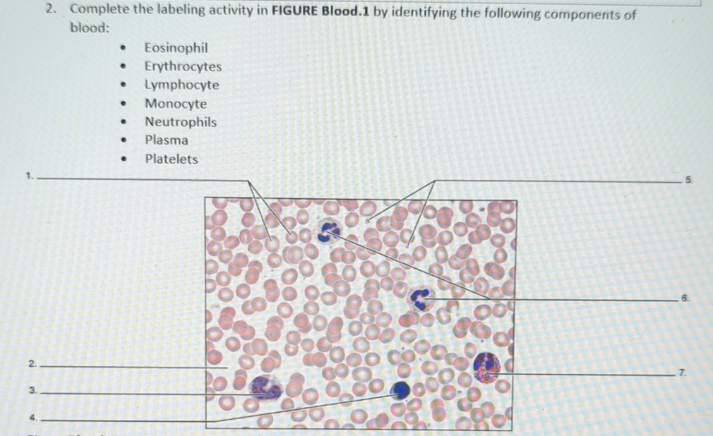 Solved Complete the labeling activity in FIGURE Blood. 1 ﻿by | Chegg.com