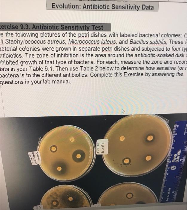 Solved Antibiotic Potency of Disk (mg) Diameter of Zone of | Chegg.com
