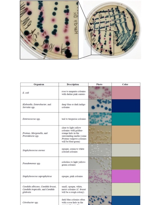 Solved Helga DX Description E.coli Tose to magenta colonies | Chegg.com