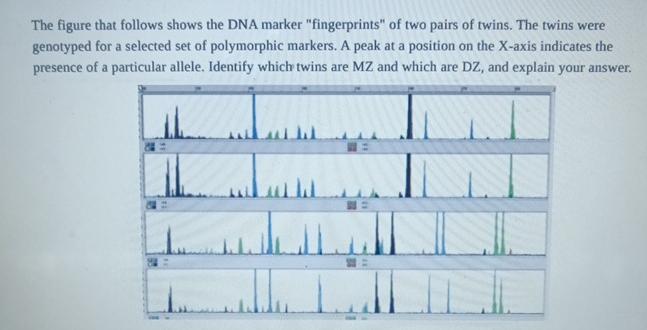 Solved The figure that follows shows the DNA marker | Chegg.com