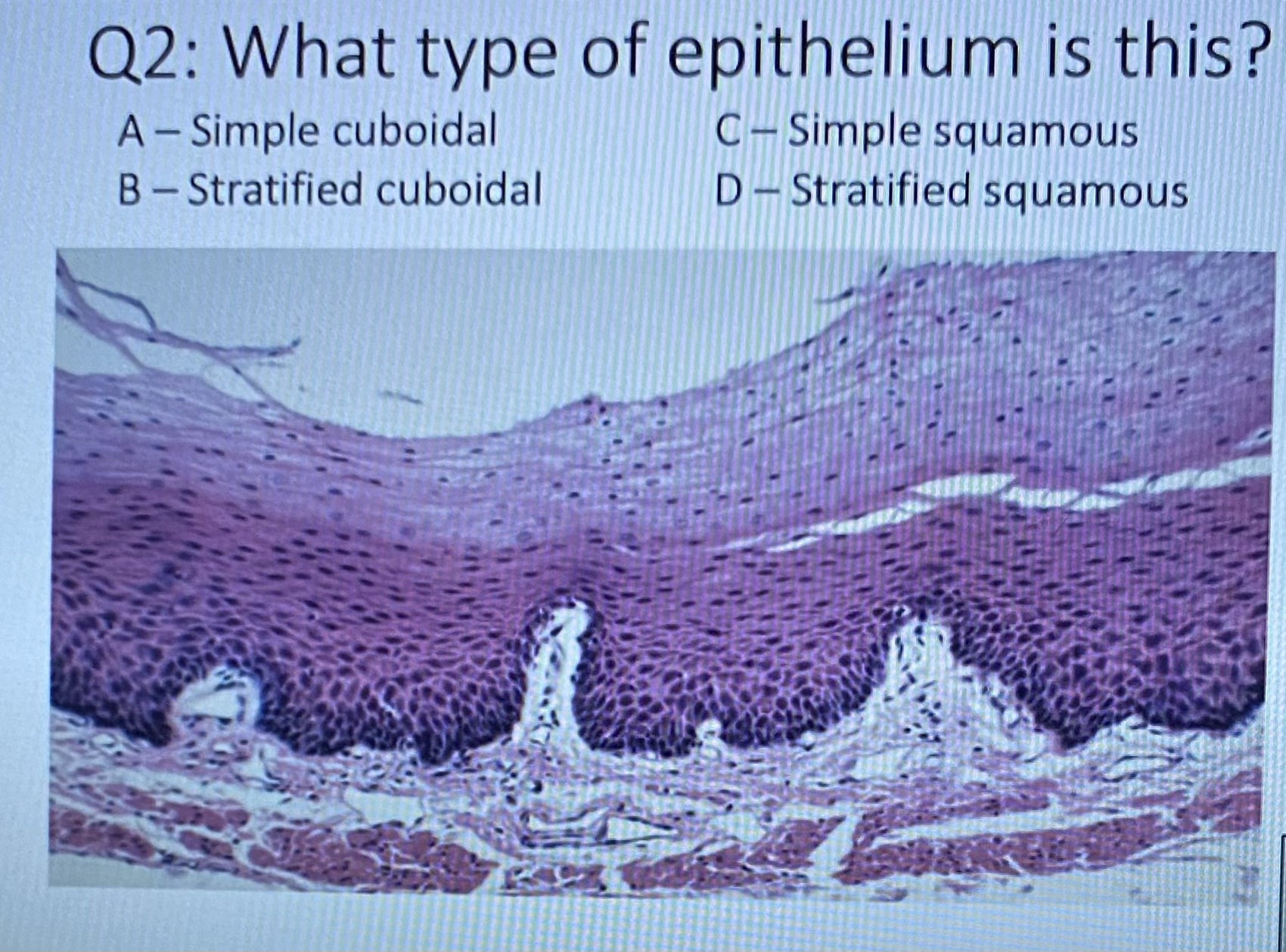 Solved Q2: What type of epithelium is this?A - ﻿Simple | Chegg.com