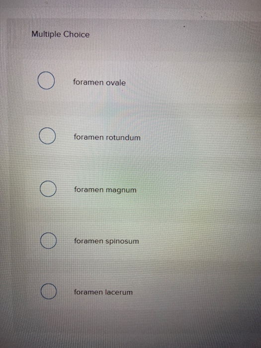 Solved Which structure is highlighted? Skull cranial cavity | Chegg.com