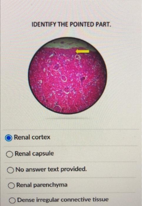 Solved IDENTIFY THE POINTED STRUCTURE. Thin ascending limb | Chegg.com