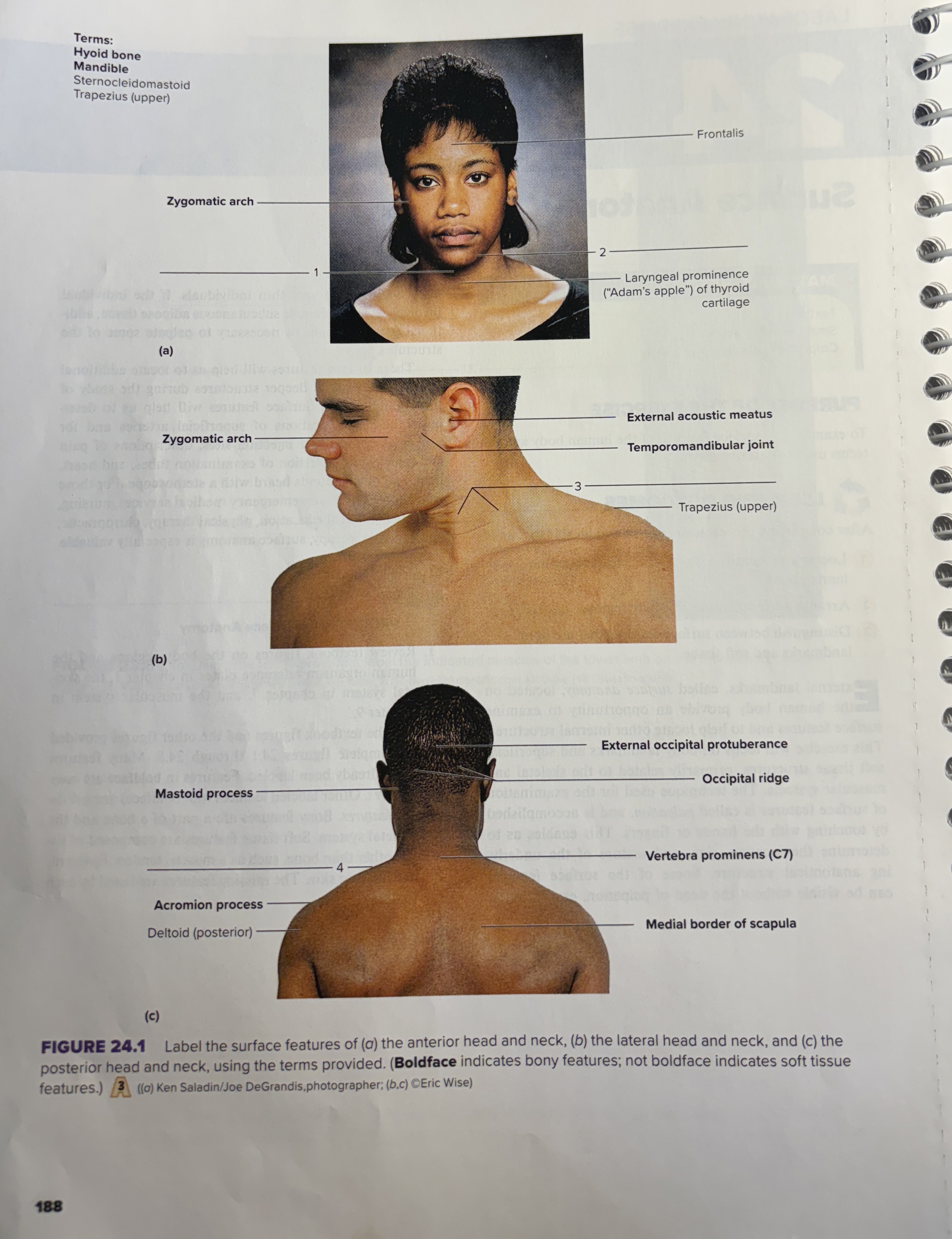 Solved FIGURE 24.1 ﻿Label the surface features of (a) ﻿the | Chegg.com