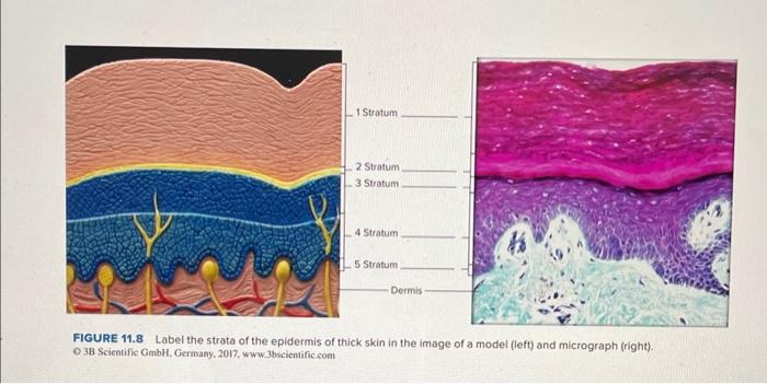 Solved FIGURE 11.8 Label the strata of the epidermis of | Chegg.com