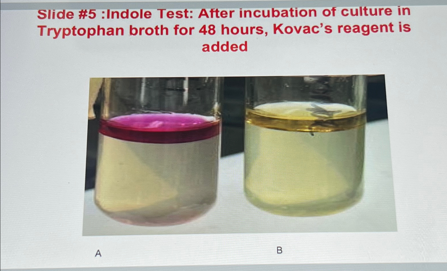 Solved Slide #5 ﻿:Indole Test: After incubation of culture | Chegg.com
