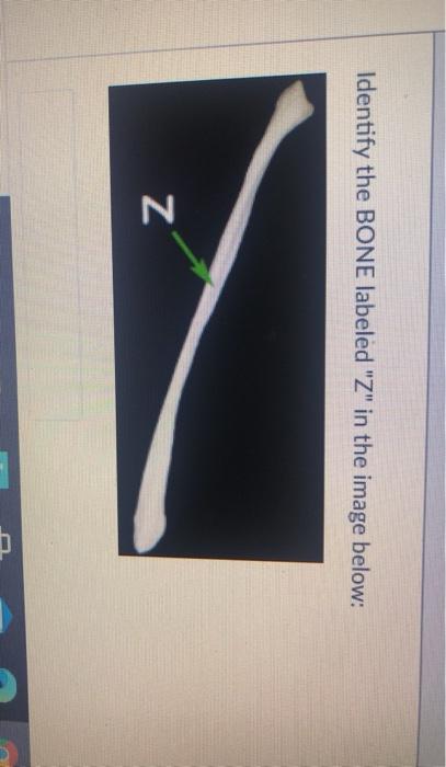 Solved Identify the BONE labeled "Z" in the image below: N | Chegg.com