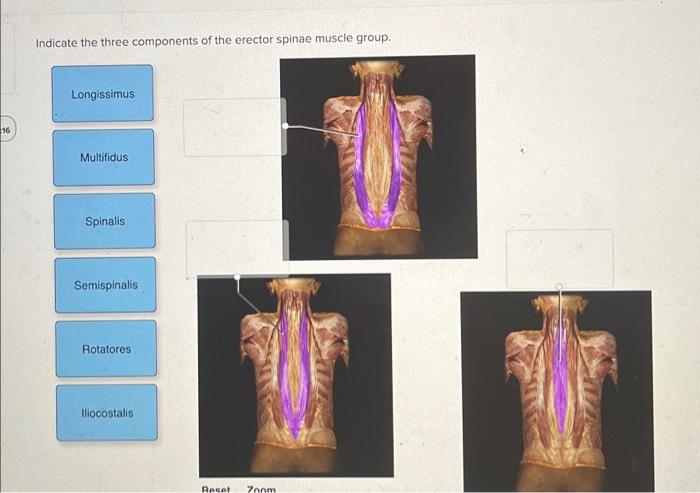 Solved Indicate the three components of the erector spinae | Chegg.com