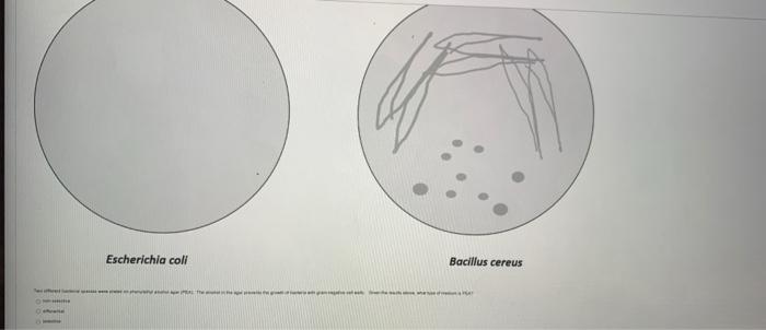 Solved MICROBIOLOGY!!!!- two different bacterial species | Chegg.com
