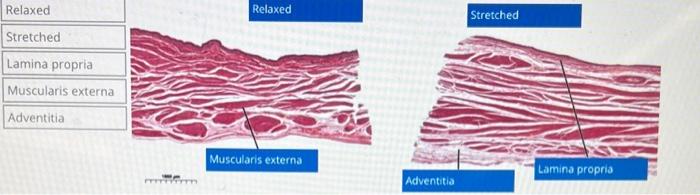 Solved Relaxed Relaxed Stretched Stretched Lamina propria | Chegg.com