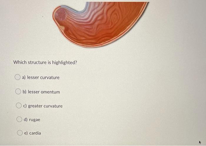 Solved Which structure is highlighted? a) lesser curvature | Chegg.com