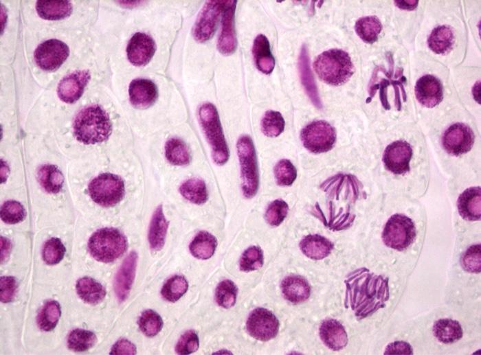Solved count the number of cells in each of the cell phases, | Chegg.com