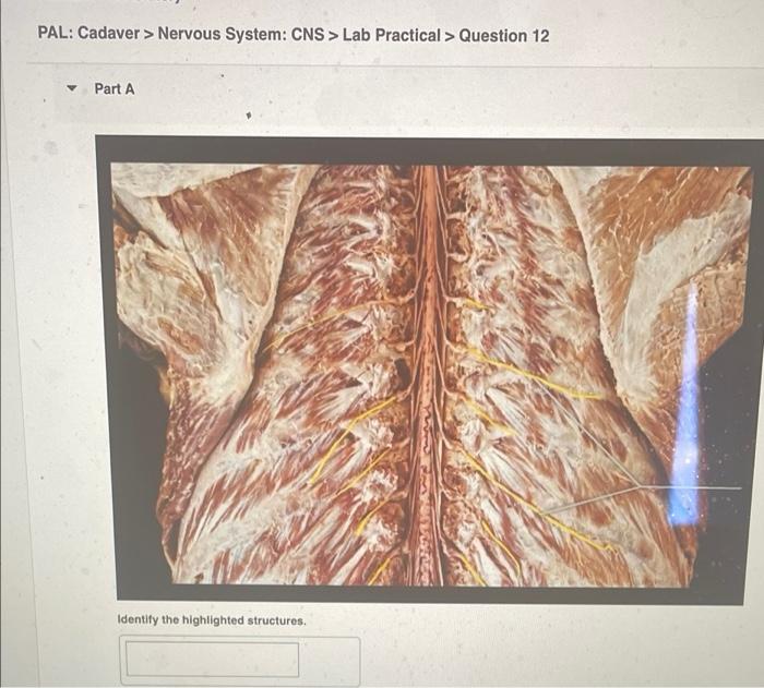 Solved Pal Cadaver Nervous System Pns Lab Practical