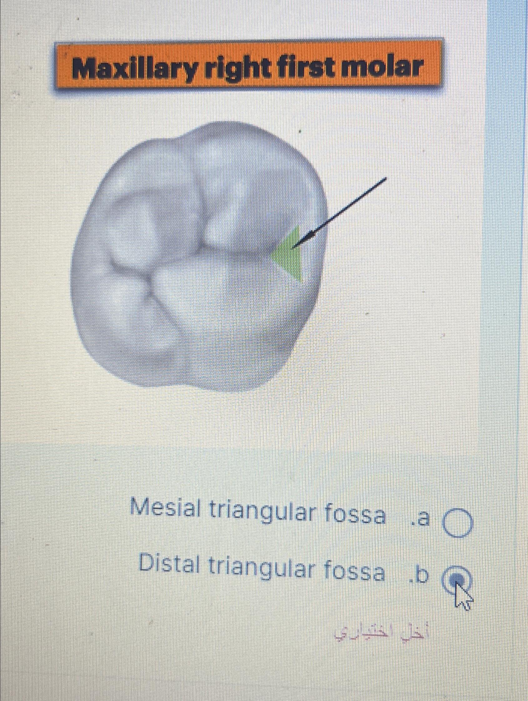 Solved Maxillary right first molarMesial triangular fossa .a | Chegg.com