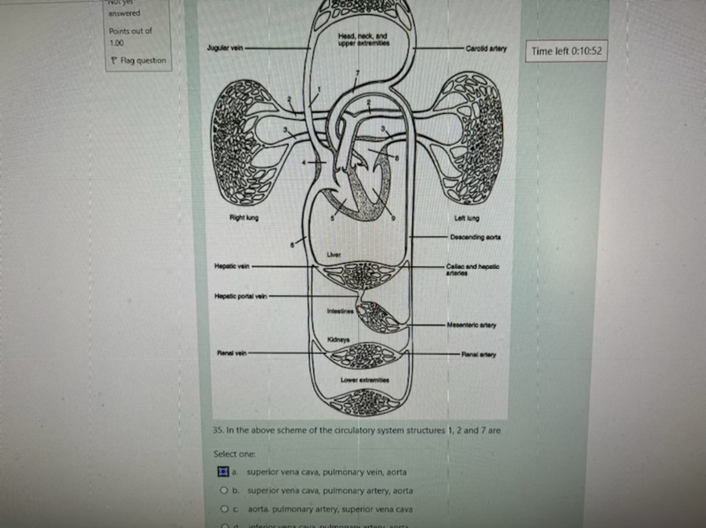 Solved In the above scheme of the circulatory system | Chegg.com