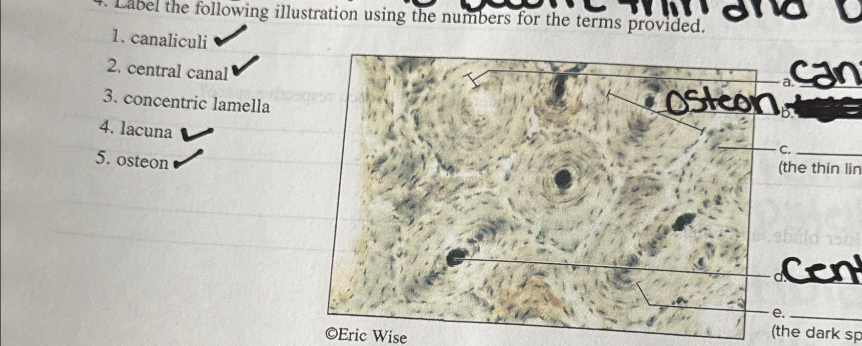 Solved Label the following illustration using the numbers | Chegg.com