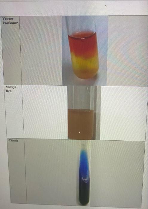Unknown Bacteria Data Sheet Your unknown bacteria | Chegg.com