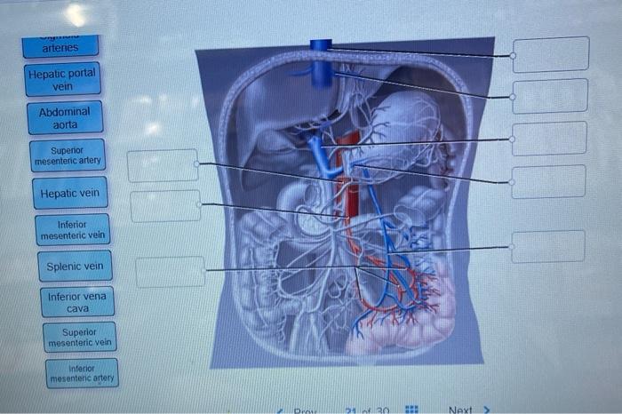 Solved Identify the blood vessels shown in the circulation | Chegg.com