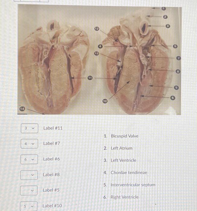 Solved Label \#11 1. Bicuspid Valve Label \#7 2. Left Atrium | Chegg.com