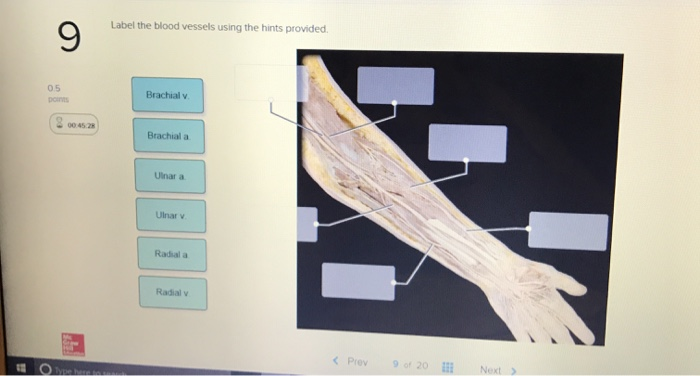 Solved: Label The Blood Vessels Using The Hints Provided B... | Chegg.com