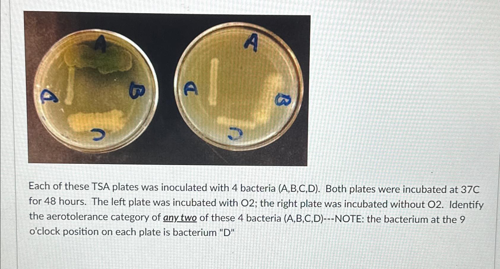 Solved Each of these TSA plates was inoculated with 4 | Chegg.com