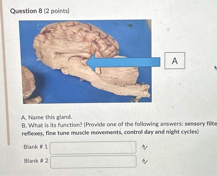 Solved Question 8 ( 2 points) A. Name this gland. B. What is | Chegg.com