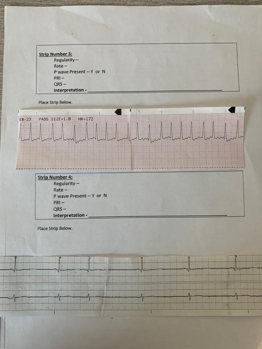 Solved I need an answer to this EKG strip.More explaination | Chegg.com
