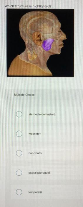 Solved Which structure is highlighted? Multiple Choice | Chegg.com