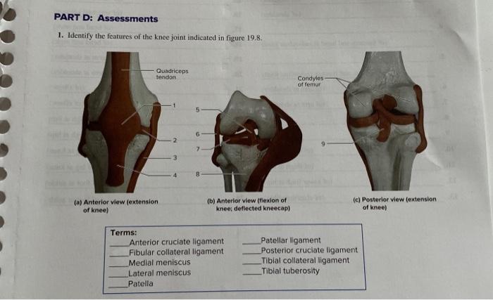 Solved 1. Identify the features of the knee joint indicated | Chegg.com