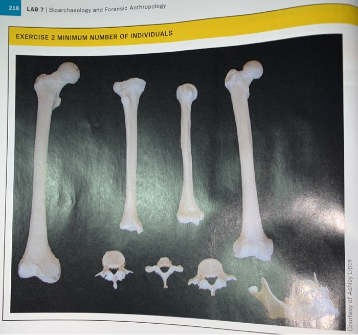Solved Refer to the skeletal material provided by Lab 7 | Chegg.com Solved Refer to the skeletal material provided by Lab 7 | Chegg.com