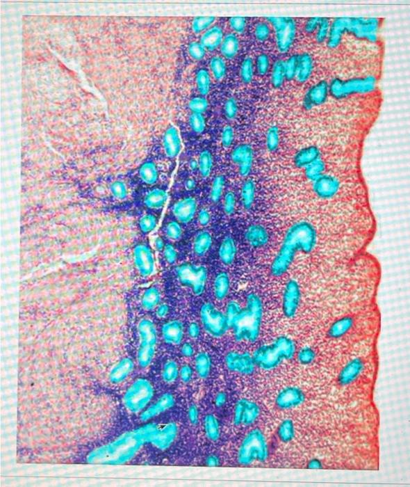 Solved a. What are the structures highlighted in aqua blue? | Chegg.com
