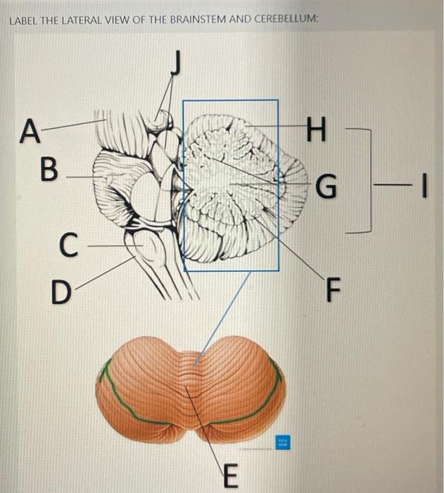 Solved LABEL THE LATERAL VIEW OF THE BRAINSTEM AND | Chegg.com