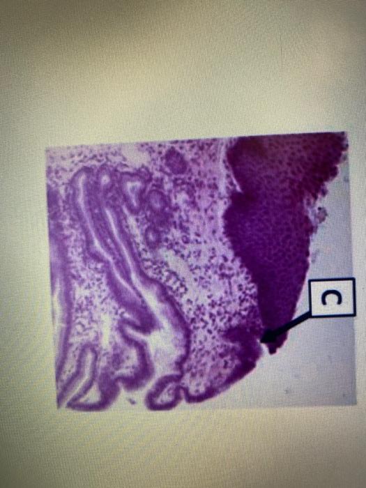 Solved Cross-section of colon. Identify the layer labeled A. | Chegg.com