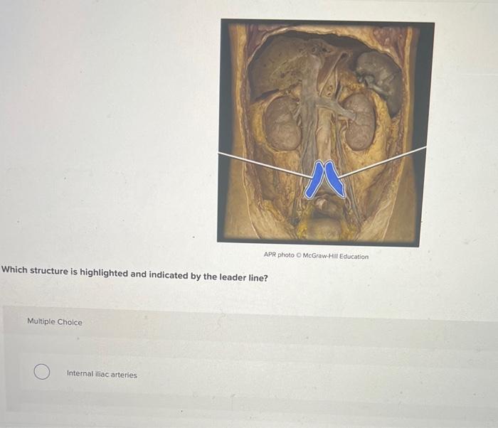 Solved APk photo O McGraw.Hill Education Which structure is | Chegg.com