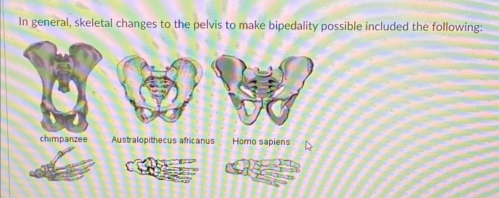 Solved In general, In general, skeletal changes to the | Chegg.com