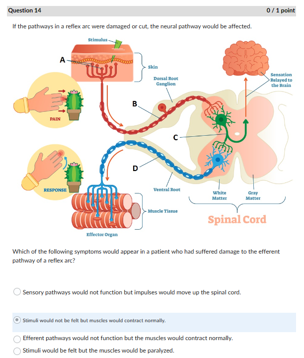 Solved Question 14If the pathways in a reflex arc were | Chegg.com