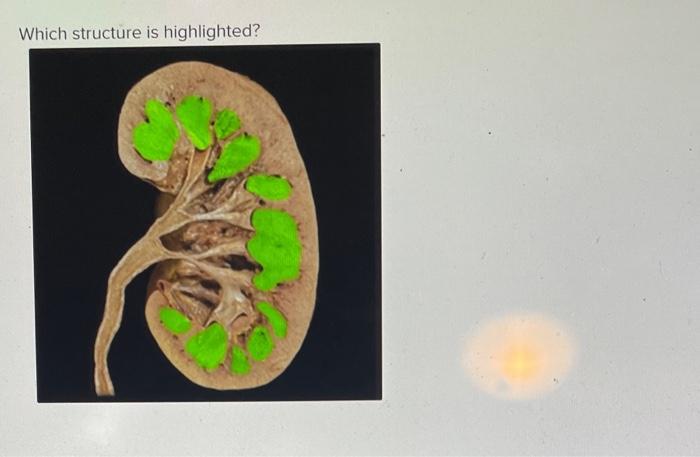 Solved Which structure is highlighted? Multiple Choice | Chegg.com