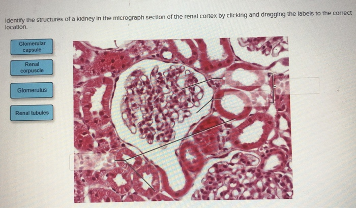 Solved: Identify The Structures Of A Kidney In The Microgr... | Chegg.com