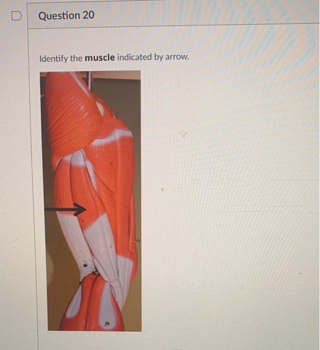 Solved Identify the muscle indicated by arrow. Identify the | Chegg.com