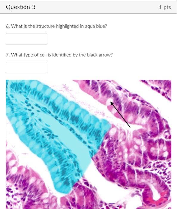 Solved Question 3 1 pts 6. What is the structure highlighted | Chegg.com