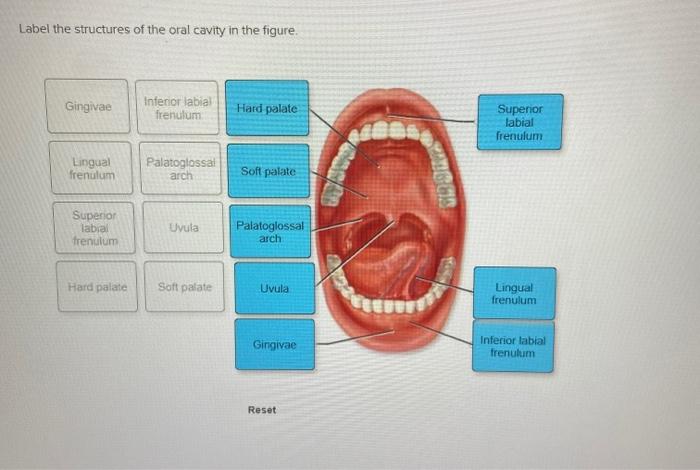 Label the structures of the oral cavity in the | Chegg.com