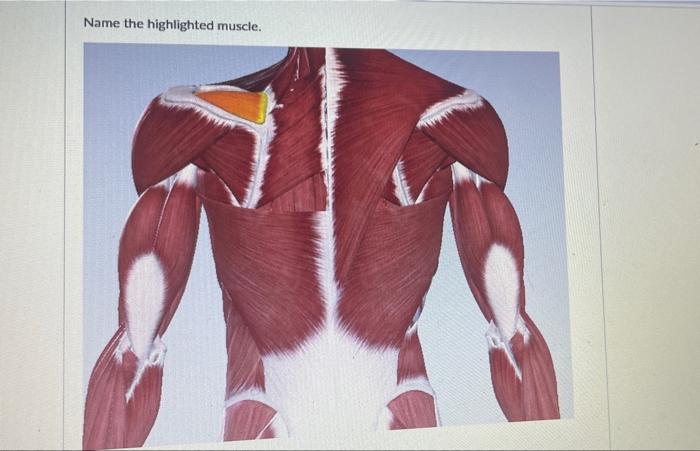 Solved Name the highlighted muscle. Name the highlighted | Chegg.com