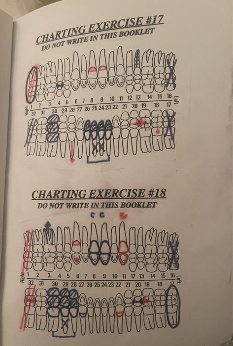 CHARTING EXERCISE \#13 CHARTING EXERCISE \#14 DONOT | Chegg.com