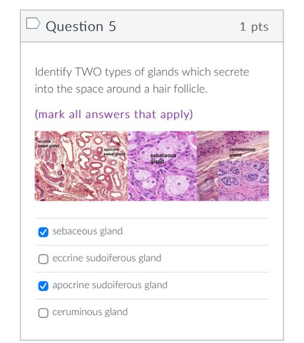 Solved Question 5 1pt Identify TWO types of glands which | Chegg.com