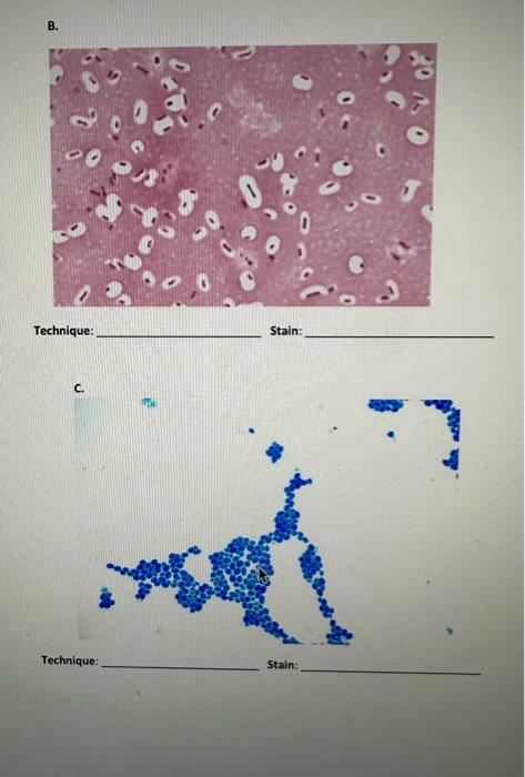Solved 12. Identify simple stain, negative stain, gram | Chegg.com
