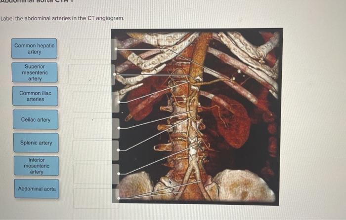 Solved Label the abdominal arteries in the CT angiogram. | Chegg.com